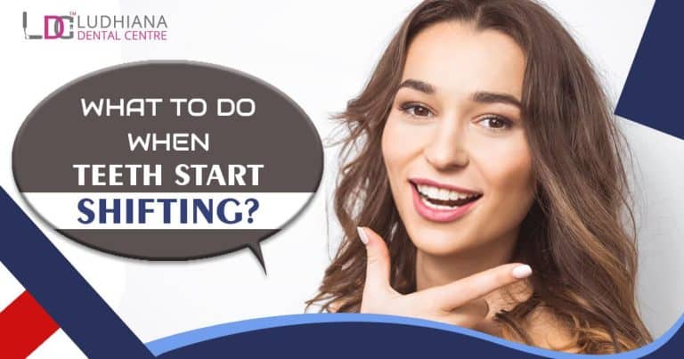 What to do when teeth start shifting?